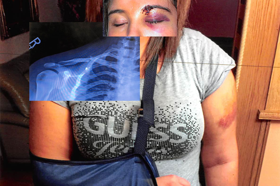 Recovering Damages from a Bad Accident With Little Insurance